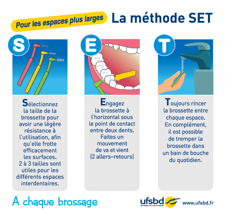 A chaque intervalle, ses outils : FIL DENTAIRE / BROSSETTE ...